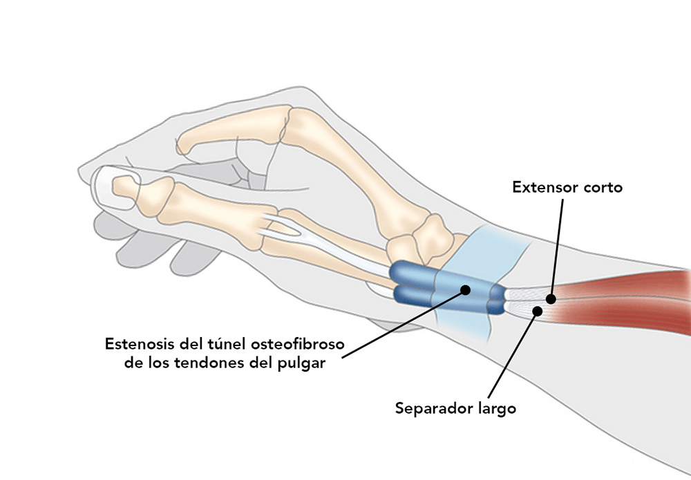 Anatomía De Los Tendones De La Muñeca Brazo, Mano, Músculos Y